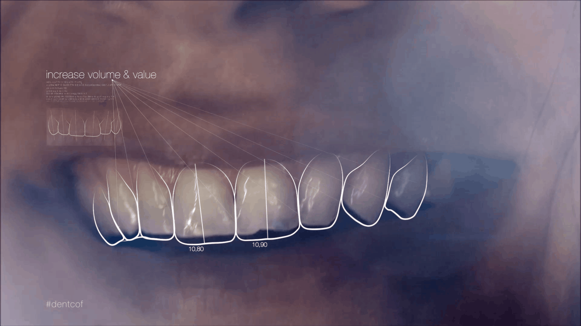 Smile Designing - GA Dental Clinics